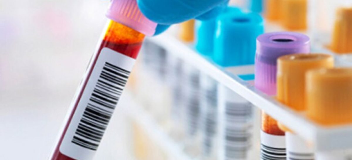 Facts About Basic Blood Testing | Healthy Panacea